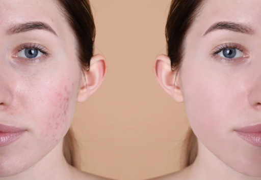 Uncovering the Techniques Used in Successful Aesthetic Medicine Patient ...